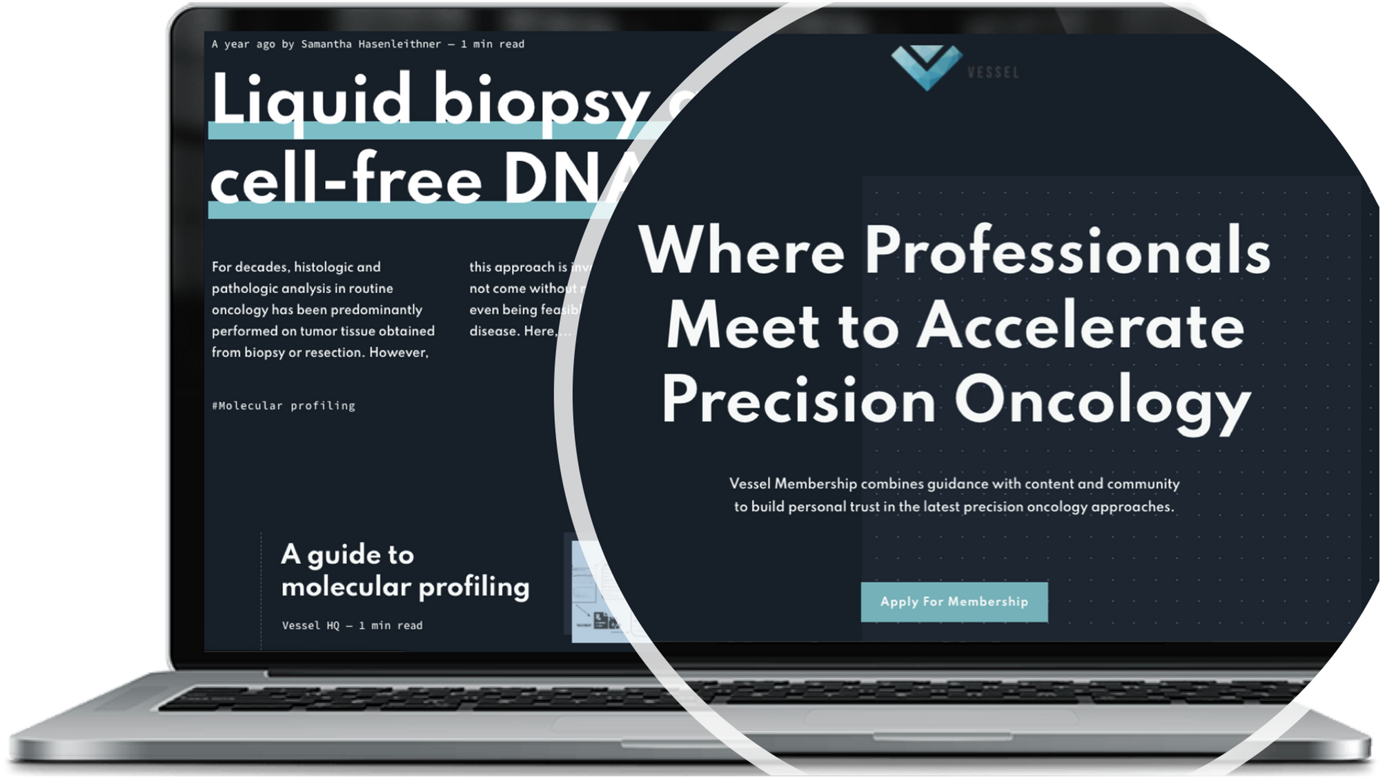 How exactly does a Vessel program work?